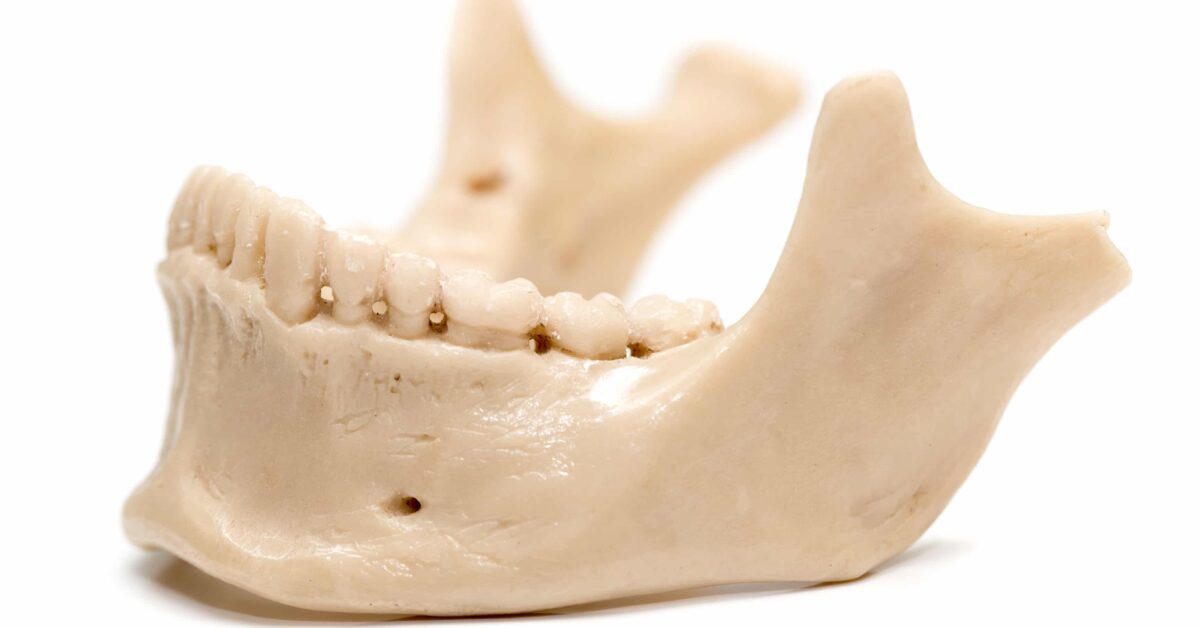 A Healthy Jaw Keeps Your Teeth in Place | Baxter, MN