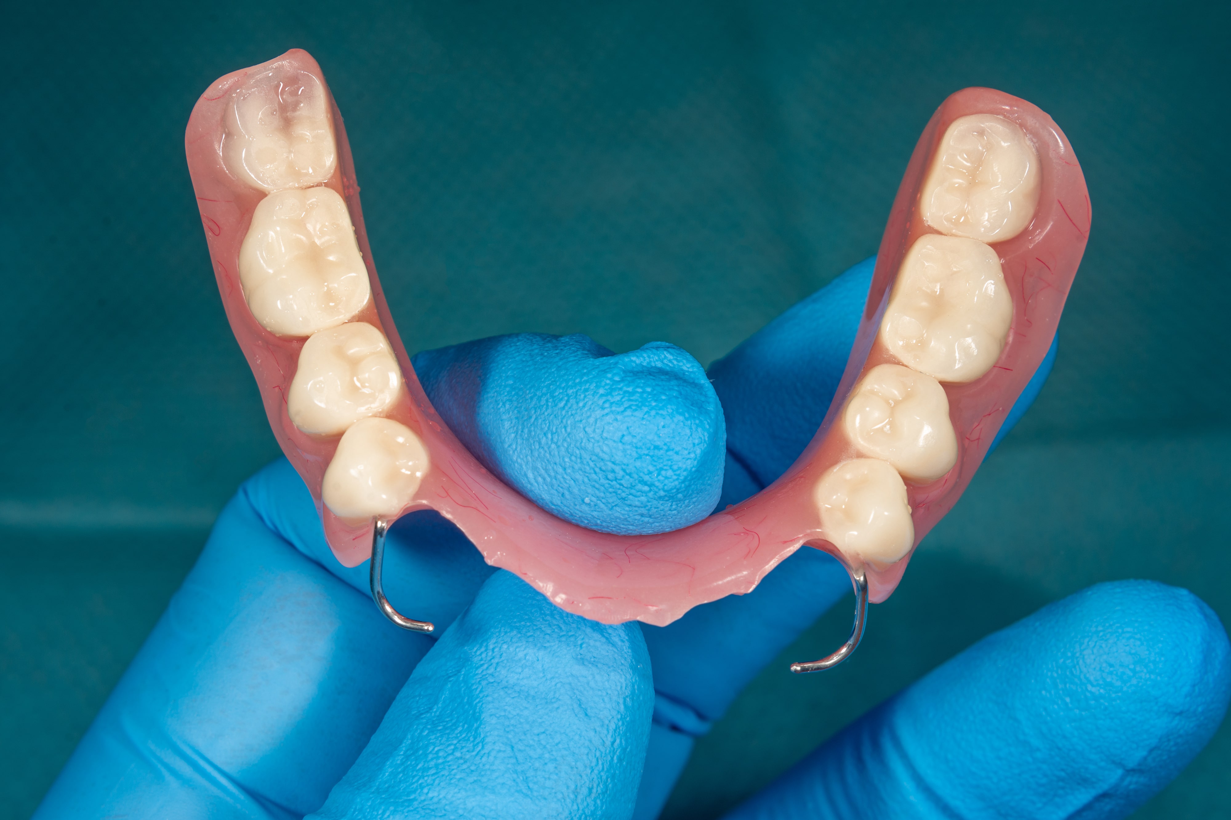 Baxter Dentist Restores Your Smile s Function With A Partial Denture